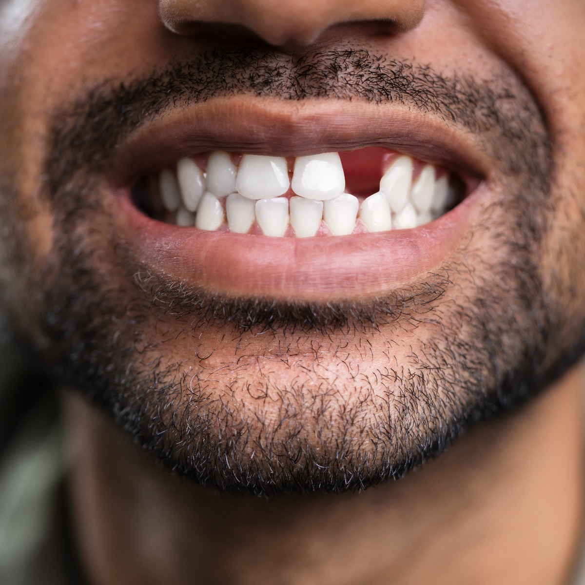 Emergency Care - Dental Care Associates